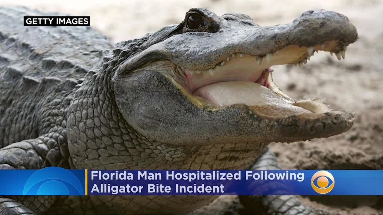 Florida Man Hospitalized Following Alligator Bite Incident In Fort ...