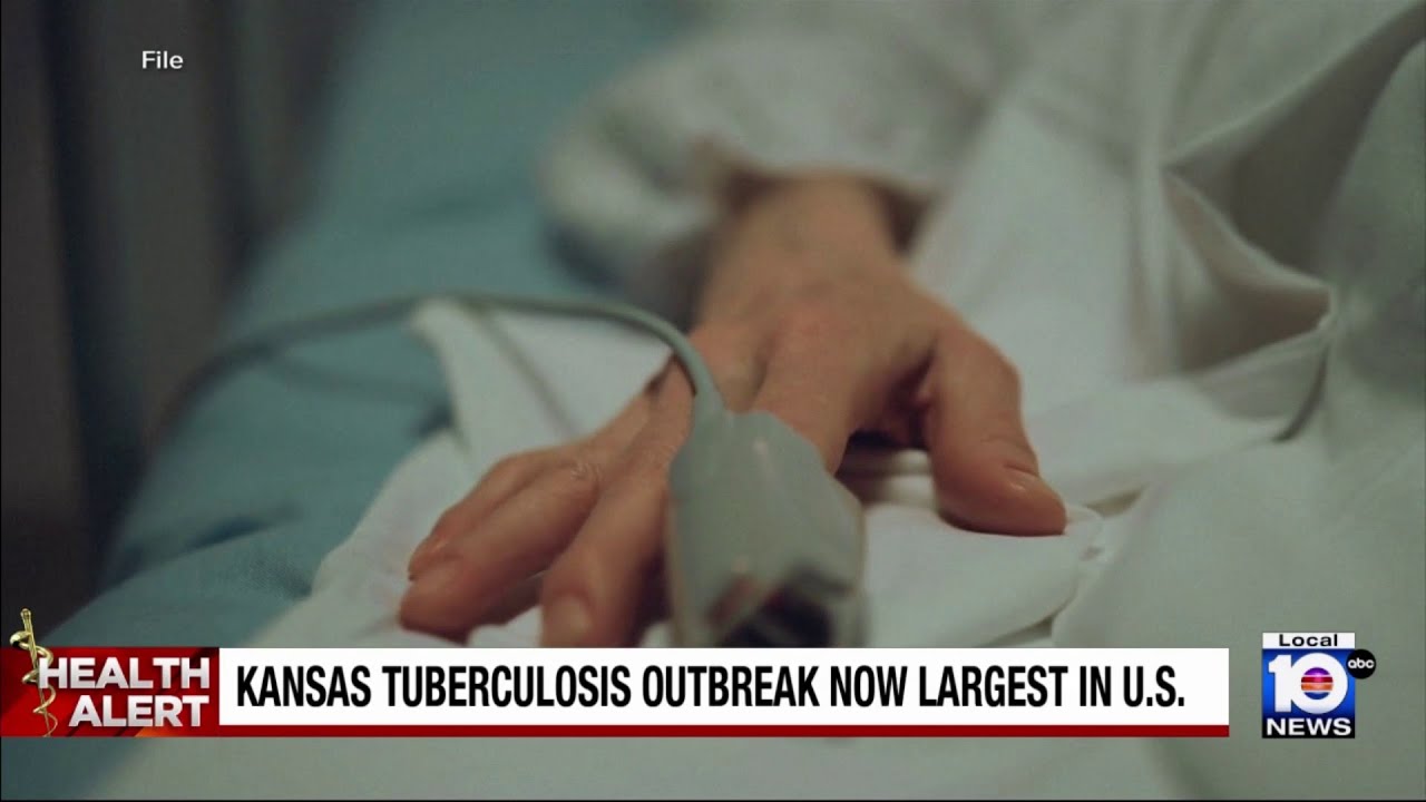 Tuberculosis outbreak includes over 65 cases in Kentucky - THE MIAMI ...